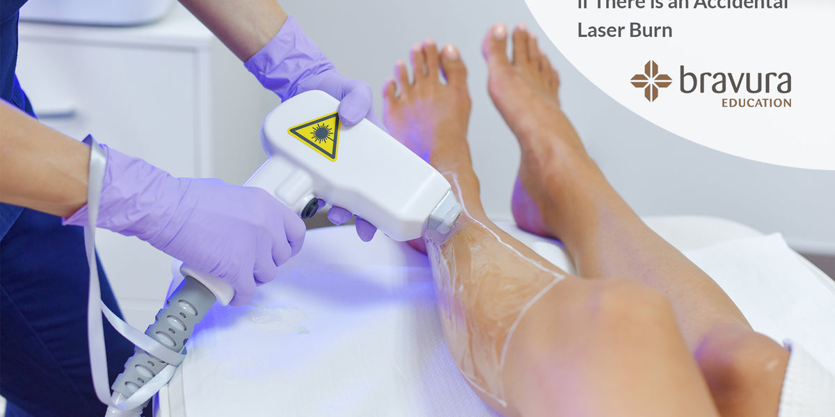 How to Help your Client if There is an Accidental Laser Burn — Bravura ...